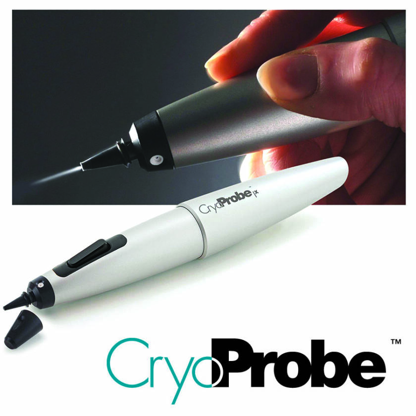 Cryoprobe® - Rejuvenations Laser Center & Medical Spa