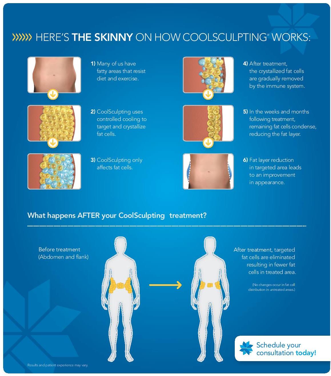 CoolSculpting® – Rejuvenations Laser Center & Medical Spa